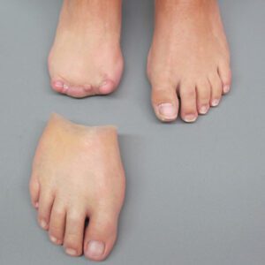 Feet - Aesthetic Prosthetics Inc®