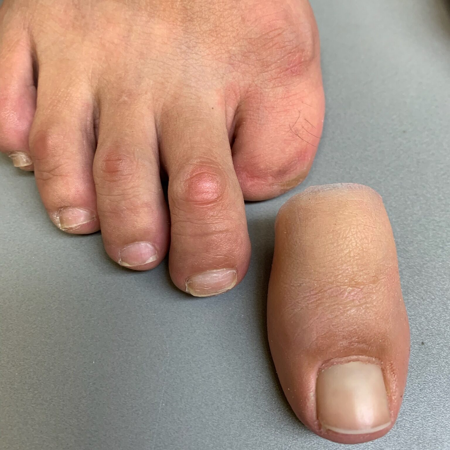 Toes - Aesthetic Prosthetics Inc®